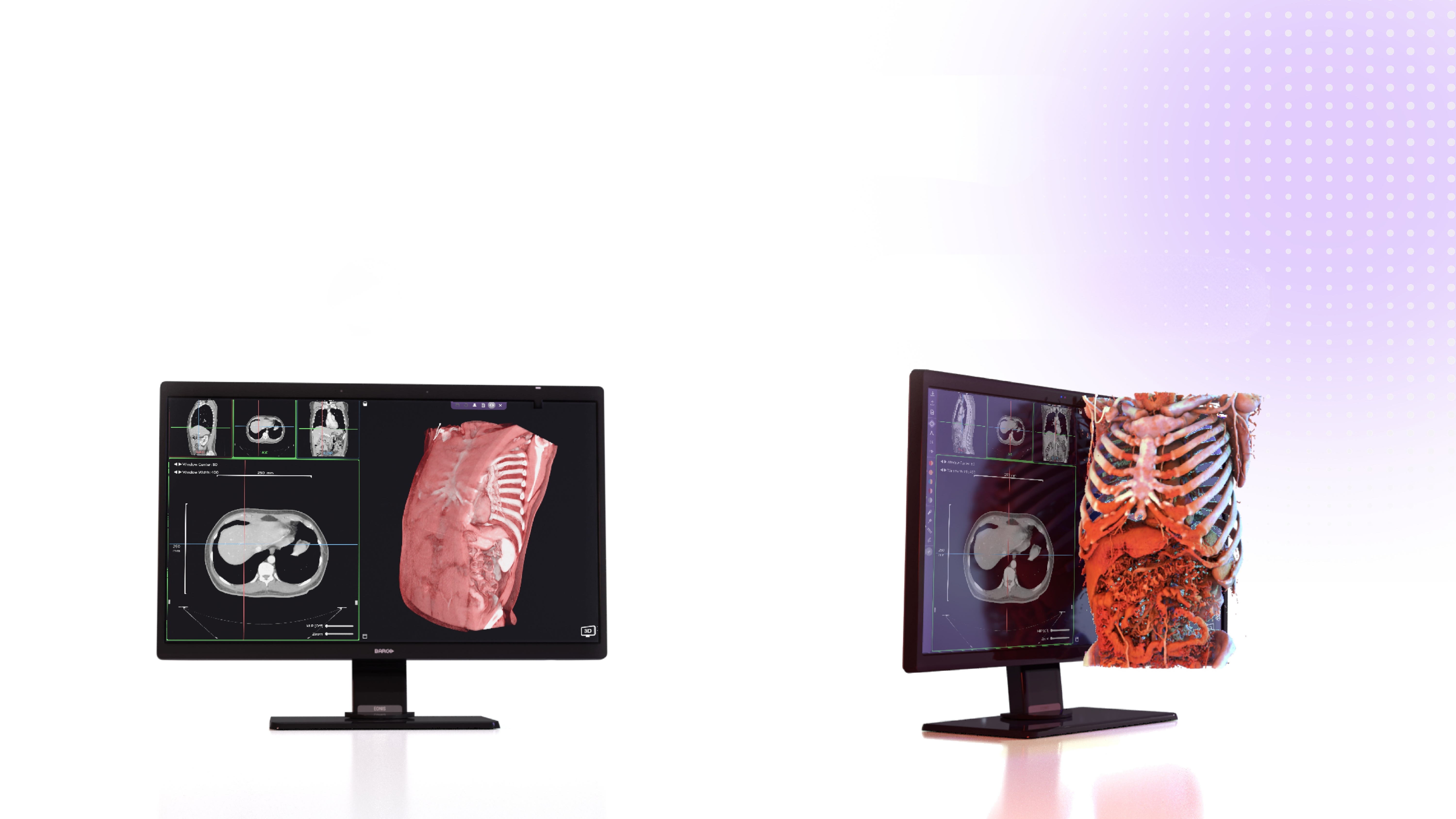 Avatar Medical and Barco Evolve Exam Room Imaging with the Launch of Eonis Vision